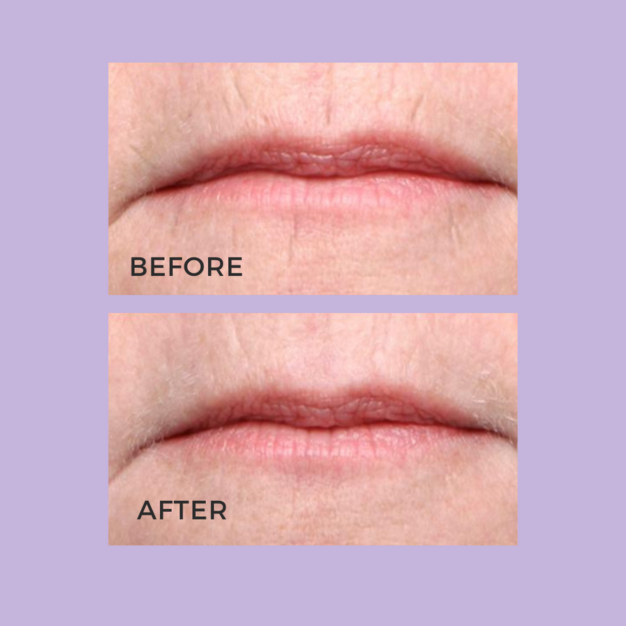 Ageless Lip & Line Filler – PRAI Beauty
