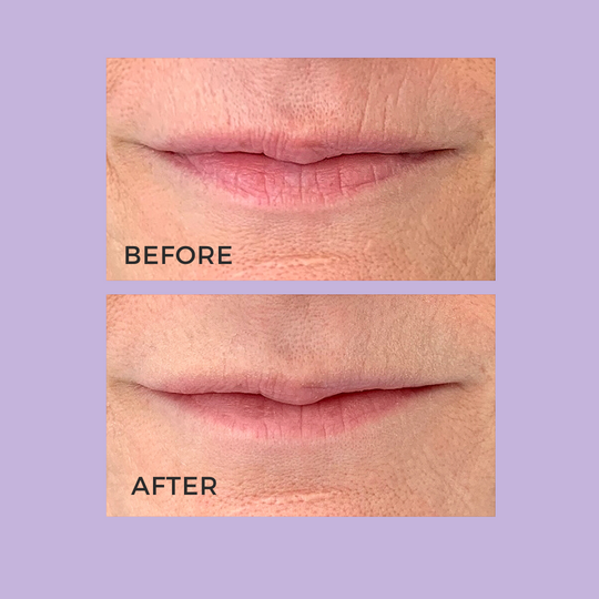 Ageless Lip & Line Filler – PRAI Beauty