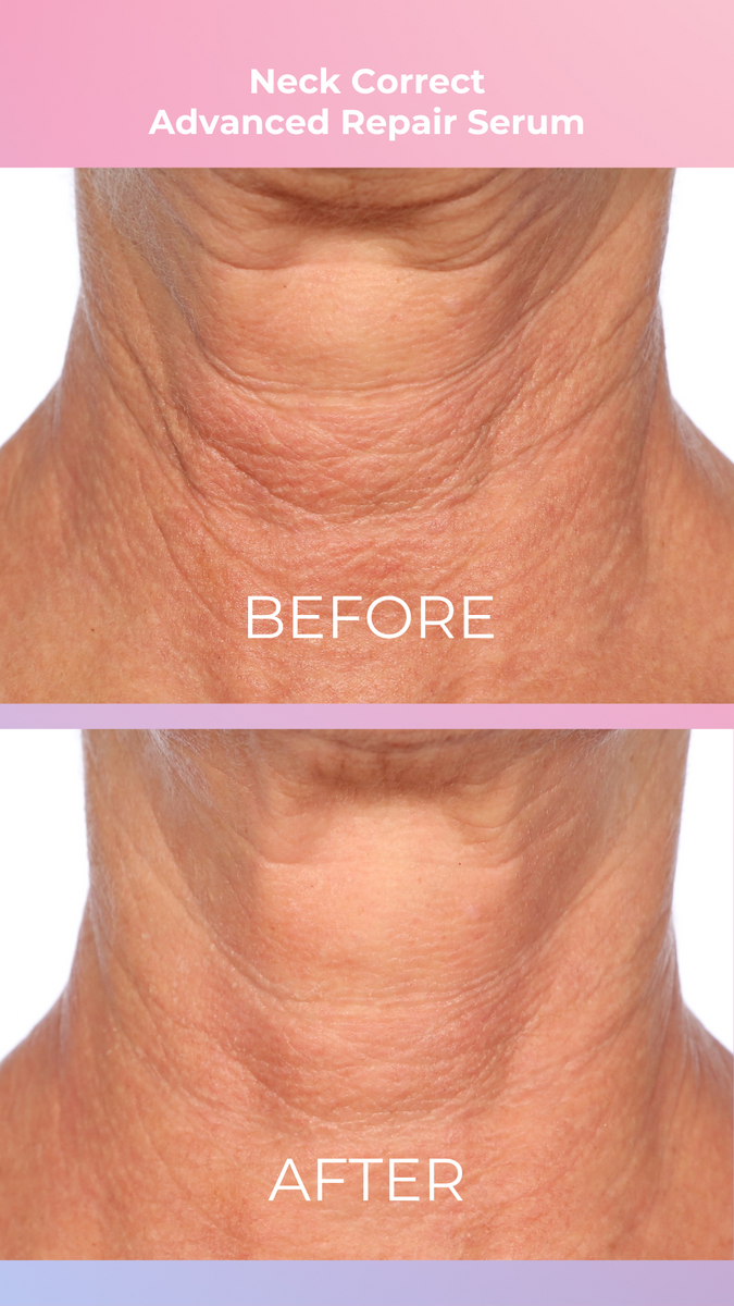 PRAI PRO Neck Correct Duo – PRAI Beauty