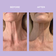 Love Your Neck Kit – PRAI Beauty