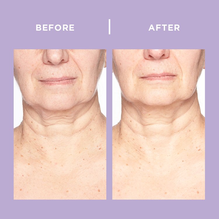 PRAI Beauty Love Your Neck Kit